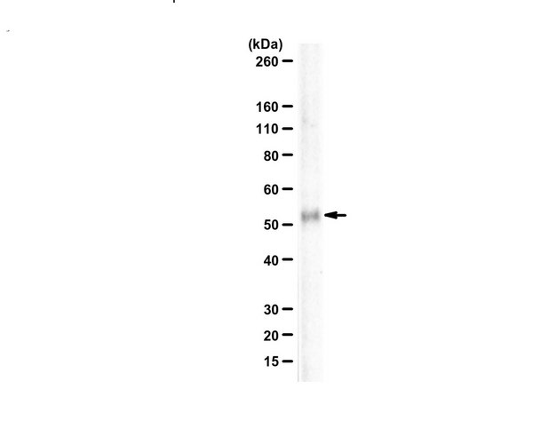 Anti-FcRn (FCGRT) | ABF191